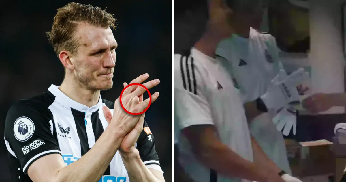 Shocking story behind Dan Burn's missing finger as he gets first ...