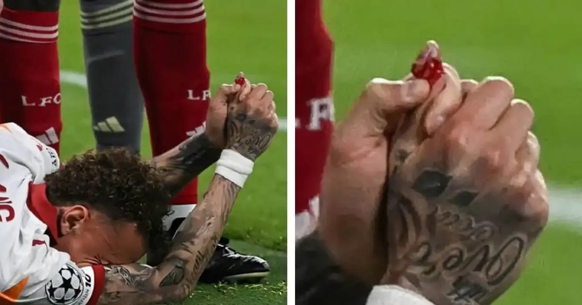 Das Chaos hinter Noa Langs schwerer Fingerverletzung in Anfield: Was ...