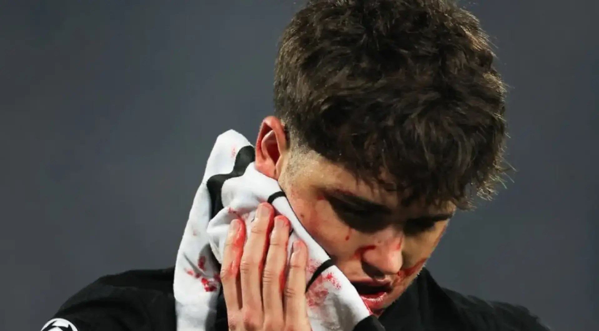 Early injury update on Cubarsi after he leaves Red Star game with ...