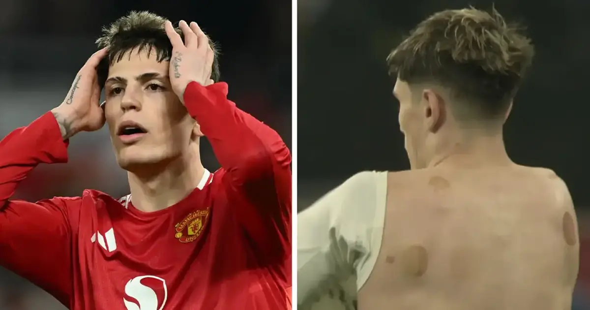 Fans notice strange marks on Garnacho's back after the game ...