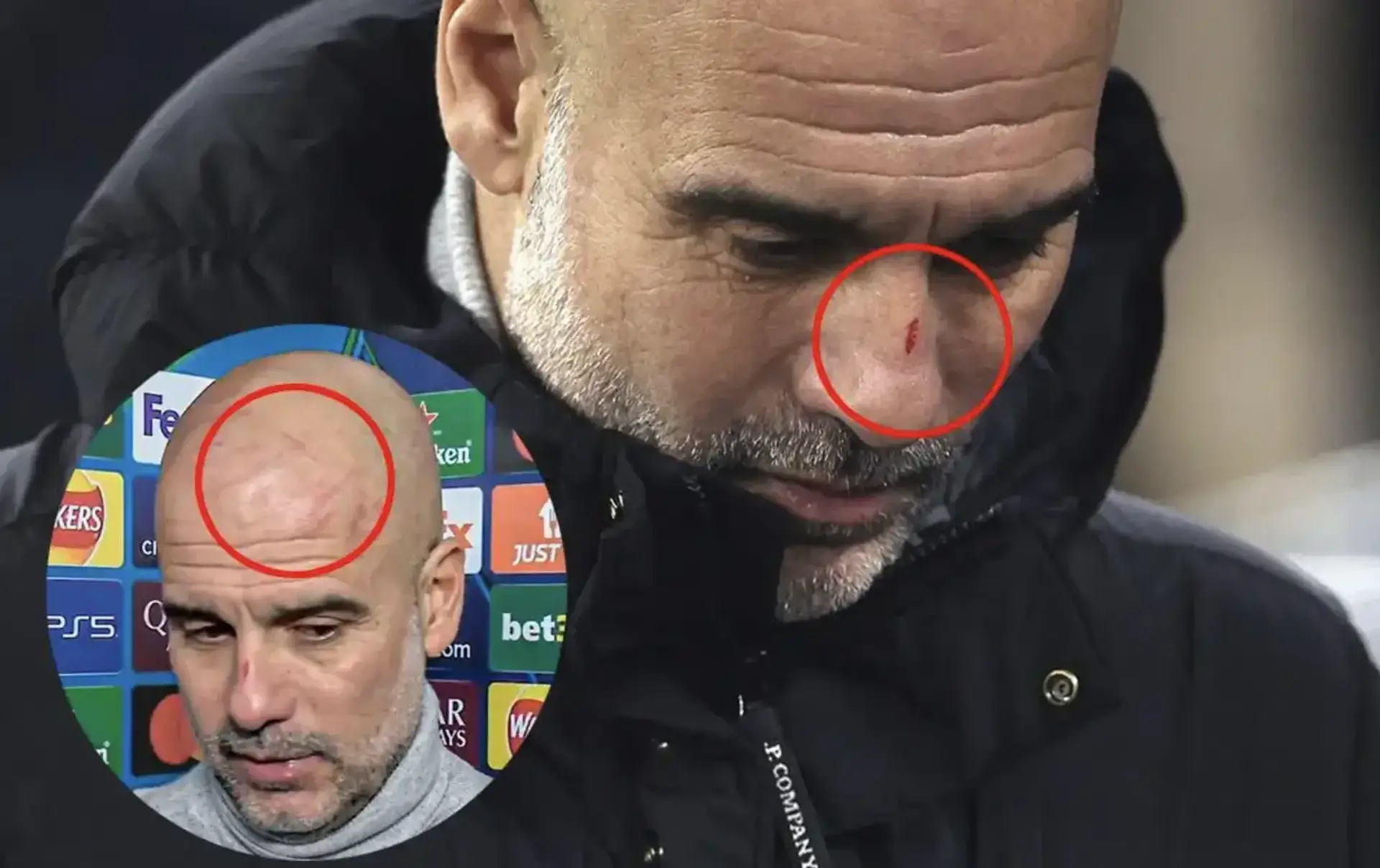 Pep Guardiola clarifies comments about facial scratches - Football ...