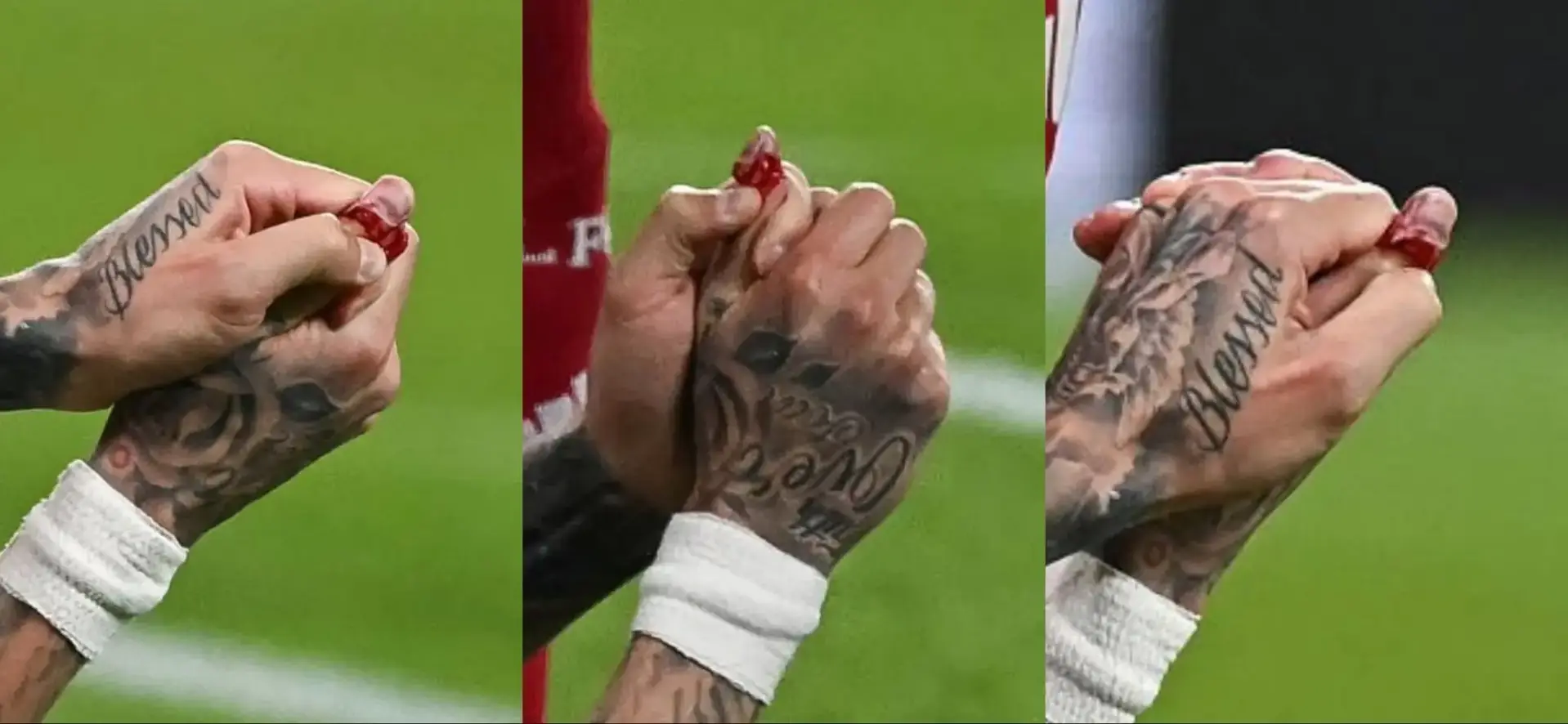 Le chaos qui a suivi la blessure au doigt de Noa Lang à Anfield — que s ...