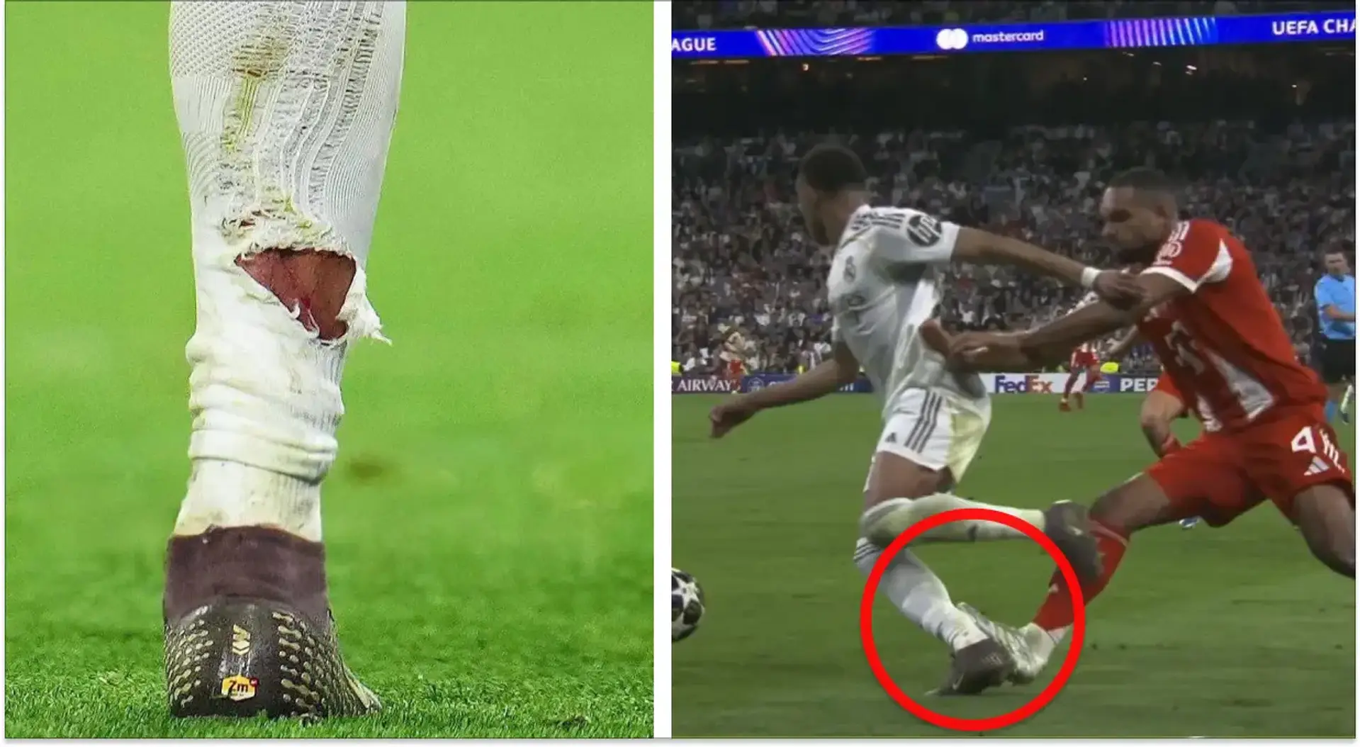 Not a red card? Mbappe left bloodied after Tah challenge in Real Madrid ...